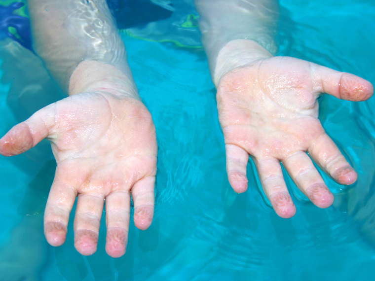 Why fingers shrivel in the water? - Padeye