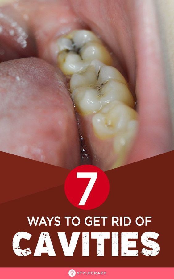 7 ways to get rid of cavities | IOHAH (Institute of Health and...